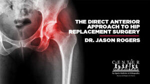 The Direct Anterior Approach to Hip Replacement Surgery
